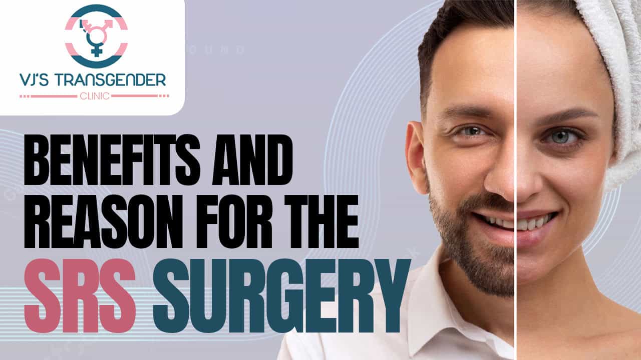 What are the different types of SRS techniques?